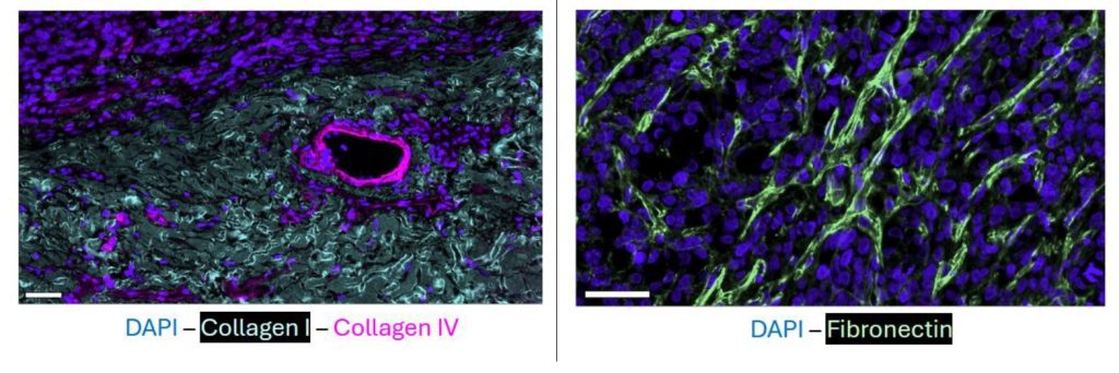 Radiation induced modulation of the extracellular matrix in paediatric ...
